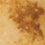 Auflichtmikroskopie - Altmeyers Enzyklopädie - Fachbereich Dermatologie