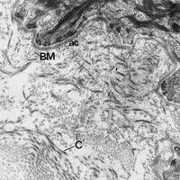 Basalmembran Bilder - Altmeyers Enzyklopädie - Fachbereich Dermatologie