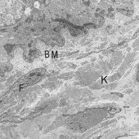 Basalmembran Bilder - Altmeyers Enzyklopädie - Fachbereich Dermatologie