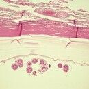 Alkoholkrankheit - Altmeyers Enzyklopädie - Fachbereich Innere Medizin