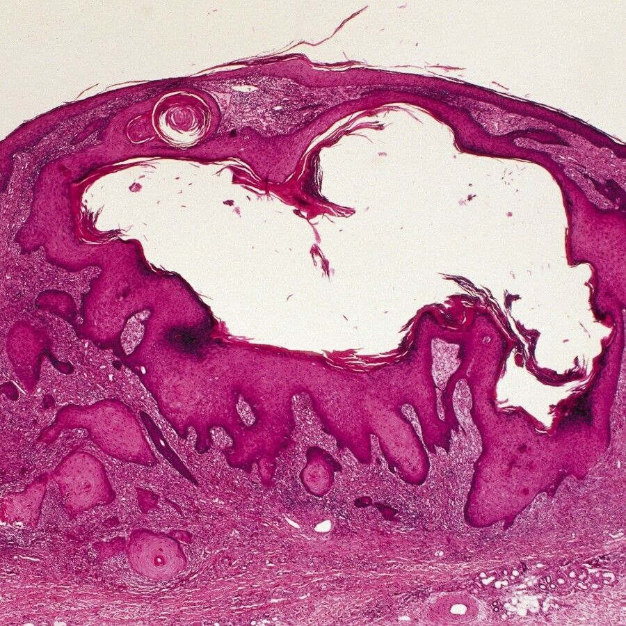 Cellula Epidermica