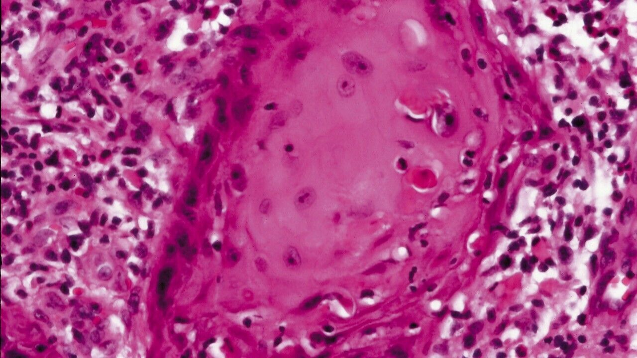 Cellula Epidermica