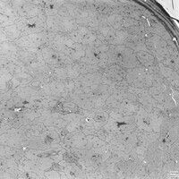 Haar (Übersicht) Bilder - Altmeyers Enzyklopädie - Fachbereich Dermatologie