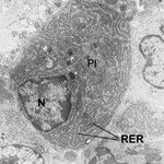 Plasmazelle - Altmeyers Enzyklopädie - Fachbereich Dermatologie