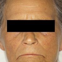 Icterus Images - Altmeyers Encyclopedia - Department Dermatology