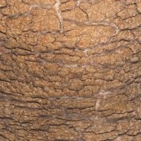 Papillomatosis cutis lymphostatica Images - Altmeyers Encyclopedia ...