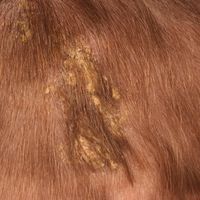 Favus Images - Altmeyers Encyclopedia - Department Dermatology