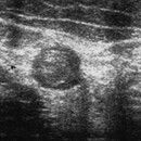 Behrend, gustav - Altmeyers Encyclopedia - Department Dermatology