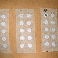Epicutaneous test Images - Altmeyers Encyclopedia - Department Allergology