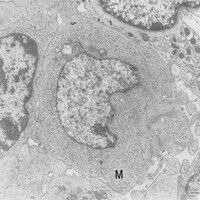 Merkel-Zelle Bilder - Altmeyers Enzyklopädie - Fachbereich Dermatologie