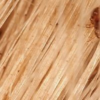 Pediculosis capitis Bilder - Altmeyers Enzyklopädie - Fachbereich ...