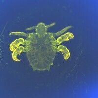 Pediculosis pubis Bilder - Altmeyers Enzyklopädie - Fachbereich ...