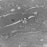 Parakeratose Bilder - Altmeyers Enzyklopädie - Fachbereich Dermatologie