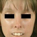 Unguentum emulsificans aquosum (dab) - Altmeyers Encyclopedia ...