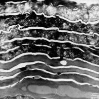 Stratum corneum Images - Altmeyers Encyclopedia - Department Dermatology
