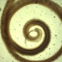 Trichuriasis Bilder - Altmeyers Enzyklopädie - Fachbereich Dermatologie