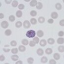 Goeckermann, william h. - Altmeyers Encyclopedia - Department Dermatology