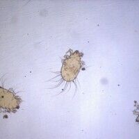 Storage mites Images - Altmeyers Encyclopedia - Department Dermatology