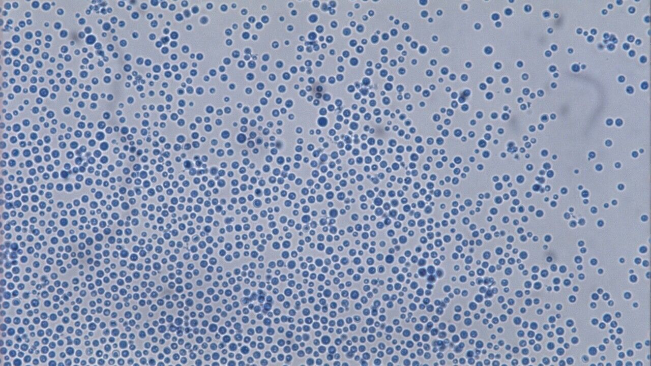 Rhodotorula Mucilaginosa