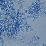 Trichophyton terrestre - Altmeyers Encyclopedia - Department Dermatology