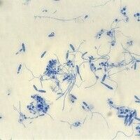 Trichophyton mentagrophytes Images - Altmeyers Encyclopedia ...