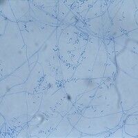 Trichophyton rubrum Images - Altmeyers Encyclopedia - Department ...