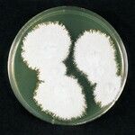 Trichophyton terrestre - Altmeyers Encyclopedia - Department Dermatology