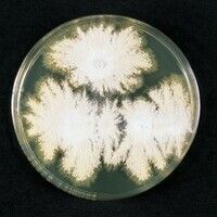 Microsporum gypseum Images - Altmeyers Encyclopedia - Department ...