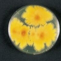 Microsporum gypseum Images - Altmeyers Encyclopedia - Department ...