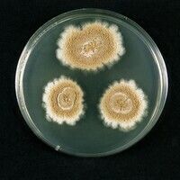 Scopulariopsis brevicaulis Images - Altmeyers Encyclopedia - Department ...