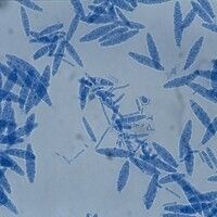 Microsporum gypseum Images - Altmeyers Encyclopedia - Department ...