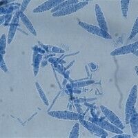 Microsporum gypseum Images - Altmeyers Encyclopedia - Department ...