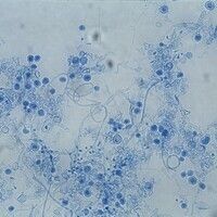 Trichophyton tonsurans Images - Altmeyers Encyclopedia - Department ...