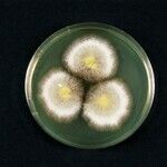 Trichophyton tonsurans - Altmeyers Encyclopedia - Department Dermatology