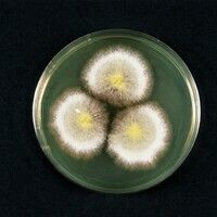 Trichophyton tonsurans Images - Altmeyers Encyclopedia - Department ...