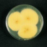 Trichophyton interdigitale Bilder - Altmeyers Enzyklopädie ...