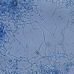 Trichophyton interdigital - Altmeyers Encyclopedia - Department Dermatology