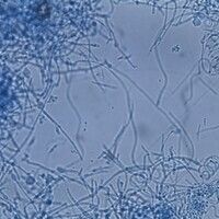 Trichophyton interdigitale Bilder - Altmeyers Enzyklopädie ...