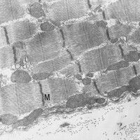 Muskelfaser Images - Altmeyers Encyclopedia - Department Dermatology