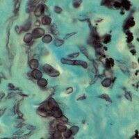 Arthrospore Images - Altmeyers Encyclopedia - Department Dermatology