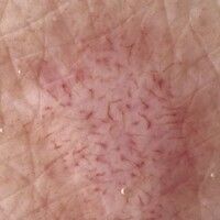 Incident light microscopy, basic architecture of polymorphic and/or ...