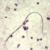 Mansonelliasis Bilder - Altmeyers Enzyklopädie - Fachbereich Dermatologie