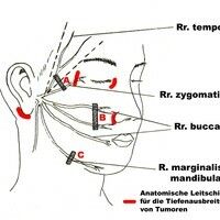 Schnittführung, fehlerhafte Bilder - Altmeyers Enzyklopädie ...