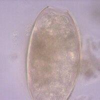 Fasciolopsiasis Images - Altmeyers Encyclopedia - Department Dermatology