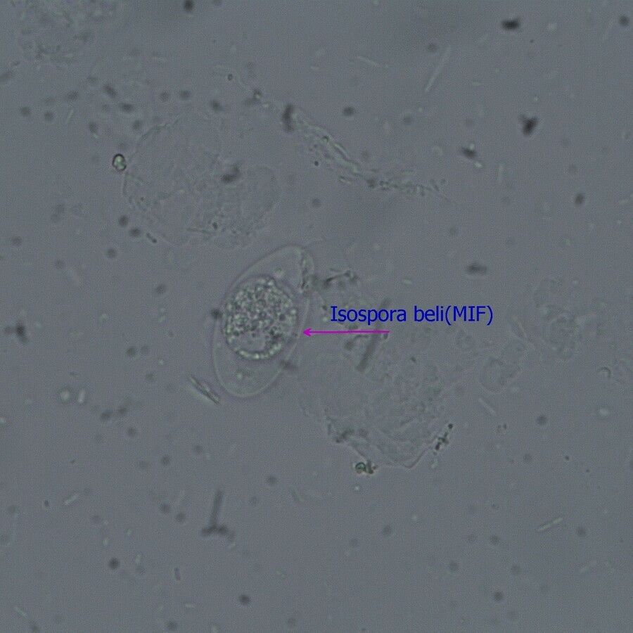 Infected By Intestens Isospora Belli