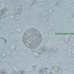 Hymenolepiasis - Altmeyers Enzyklopädie - Fachbereich Dermatologie