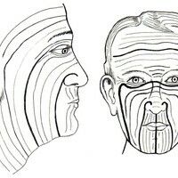 Skin tension lines Images - Altmeyers Encyclopedia - Department Dermatology