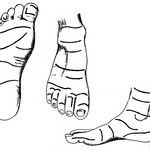 Skin tension lines - Altmeyers Encyclopedia - Department Dermatology