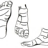 Skin tension lines Images - Altmeyers Encyclopedia - Department Dermatology