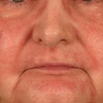 Airborne contact dermatitis - Altmeyers Encyclopedia - Department ...